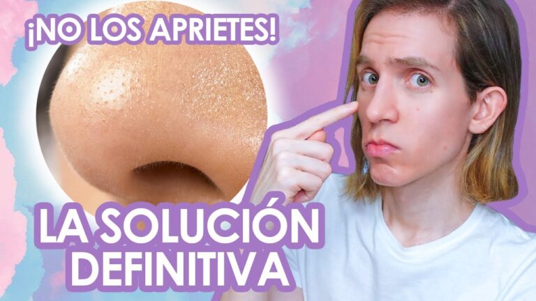 6 métodos efectivos para eliminar las espinillas de la nariz de forma ...