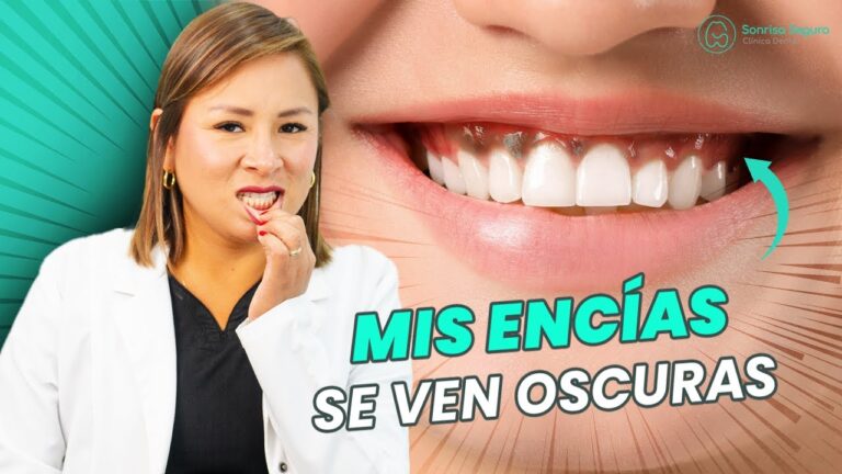 Guía completa sobre encía negra alrededor del diente: causas, síntomas ...