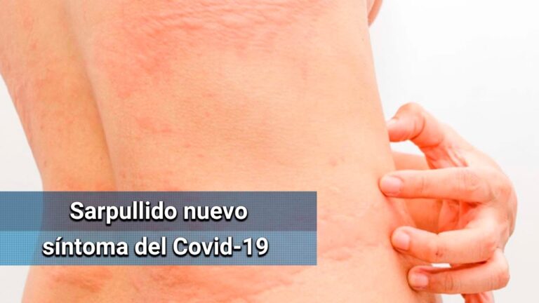 Descubre los diferentes tipos de erupciones en la piel: Guía completa ...